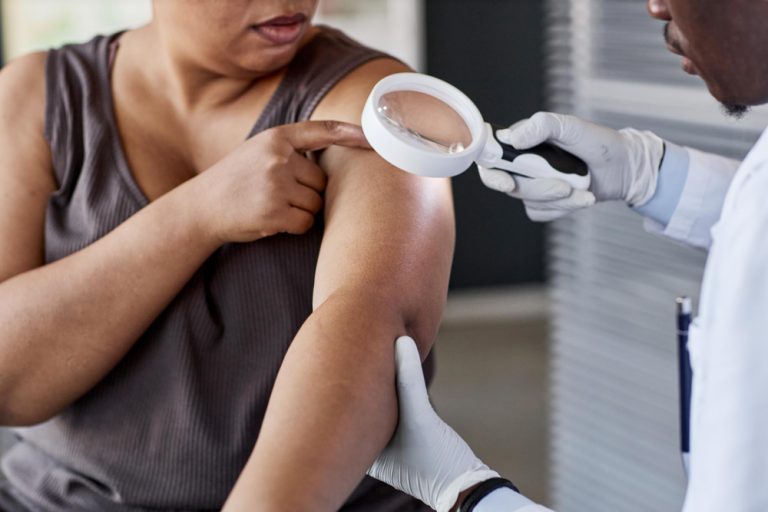 Skin Cancer Screening in San Antonio and Zapata, TX | Alamo City ...